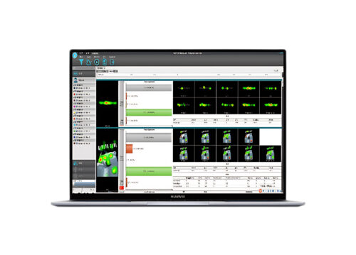 干货|详解EEG脑电原理及两种主流脑电设备对比 - 赢富仪器-多模态数据同步分析平台-压力分布测试系统-近红外脑成像-表面肌电-眼动仪